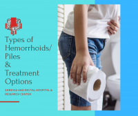 Types of Hemorrhoids - Piles & Treatment options - Proctocure
